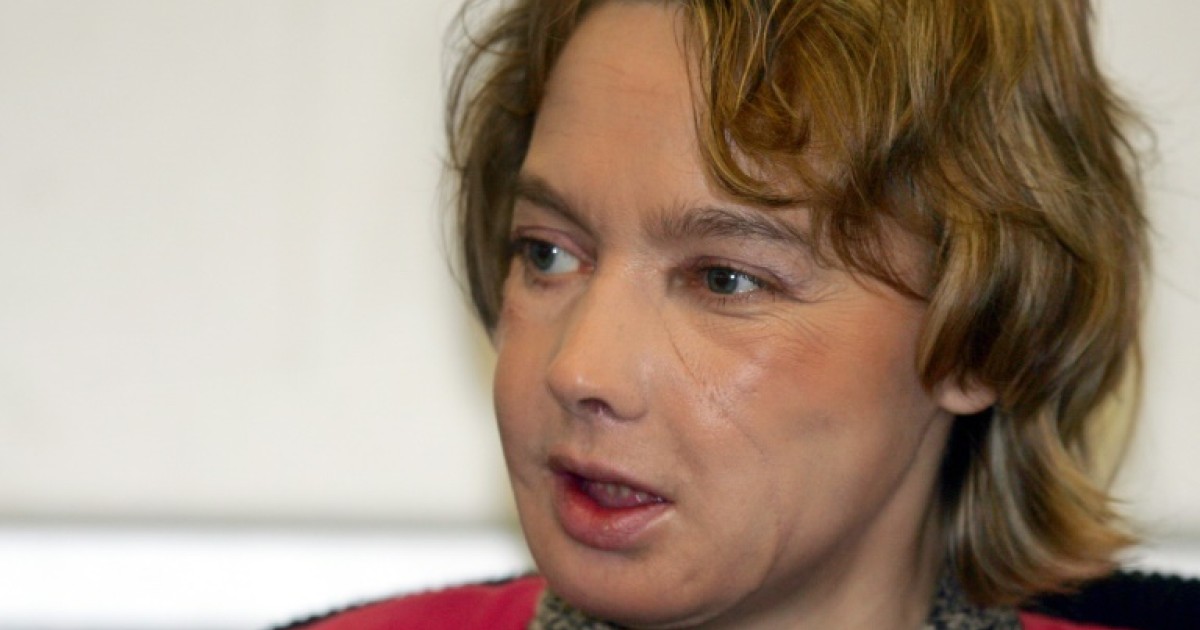 Greffe du visage: la patiente est décédée d'une "tumeur maligne rare"